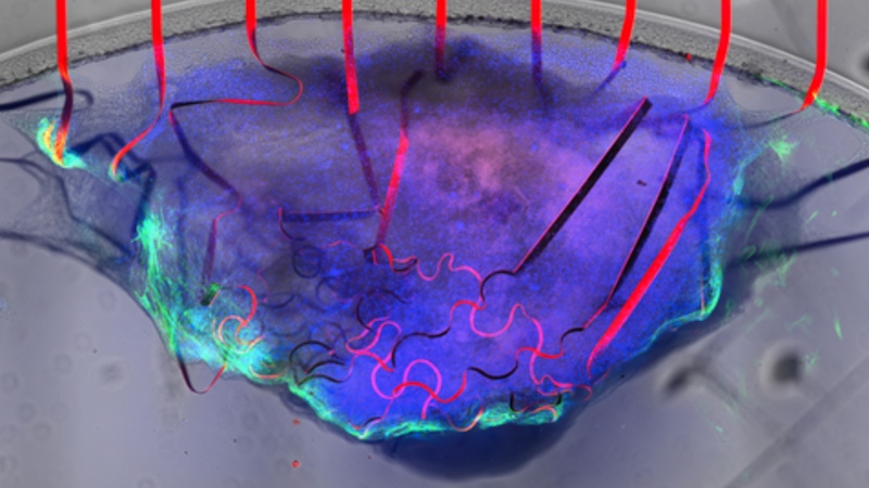 Heart Sensor Grows With Tissue to Measure Both Mechanical, Electrical ...