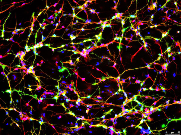 Electronic Synapses: One Step Closer to Creating Artificial Neural ...