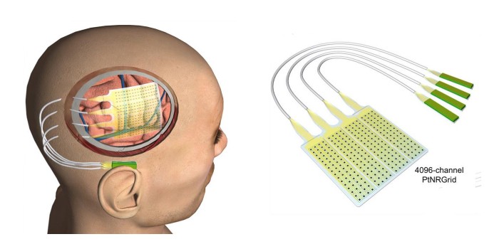 The Head and the Heart: UC San Diego Engineers Devise Neural and ...